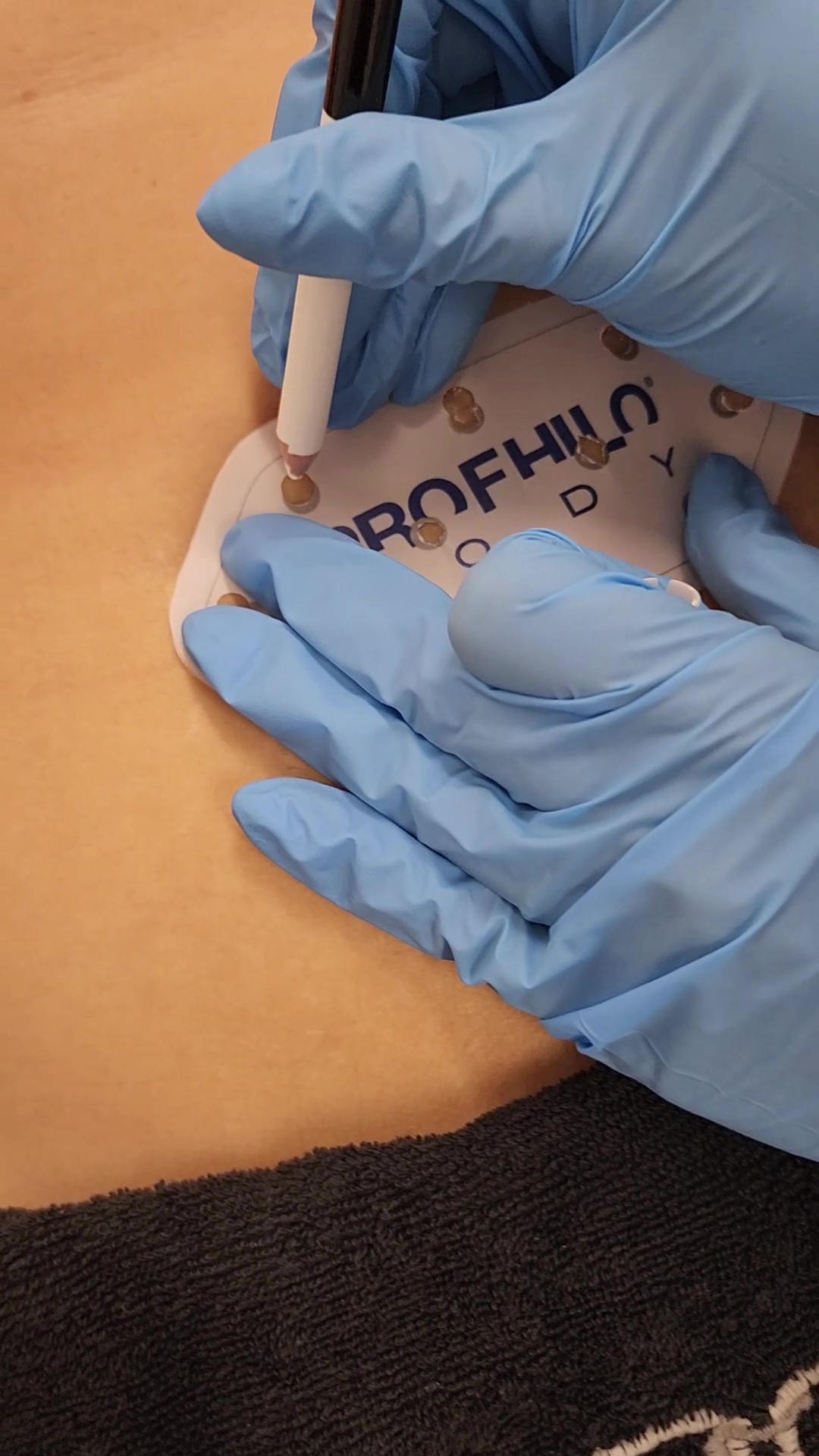 Profhilo skin booster - Crystal Care Clinic