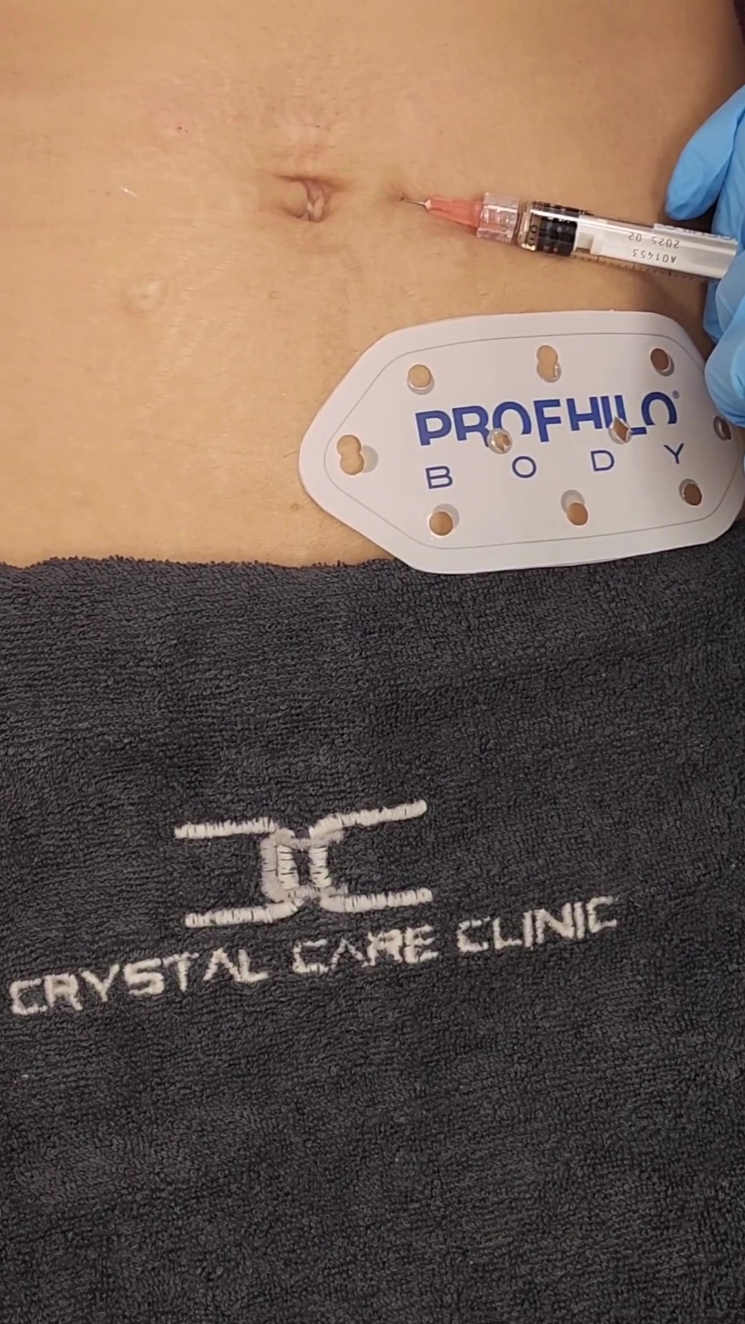 Profhilo skin booster - Crystal Care Clinic