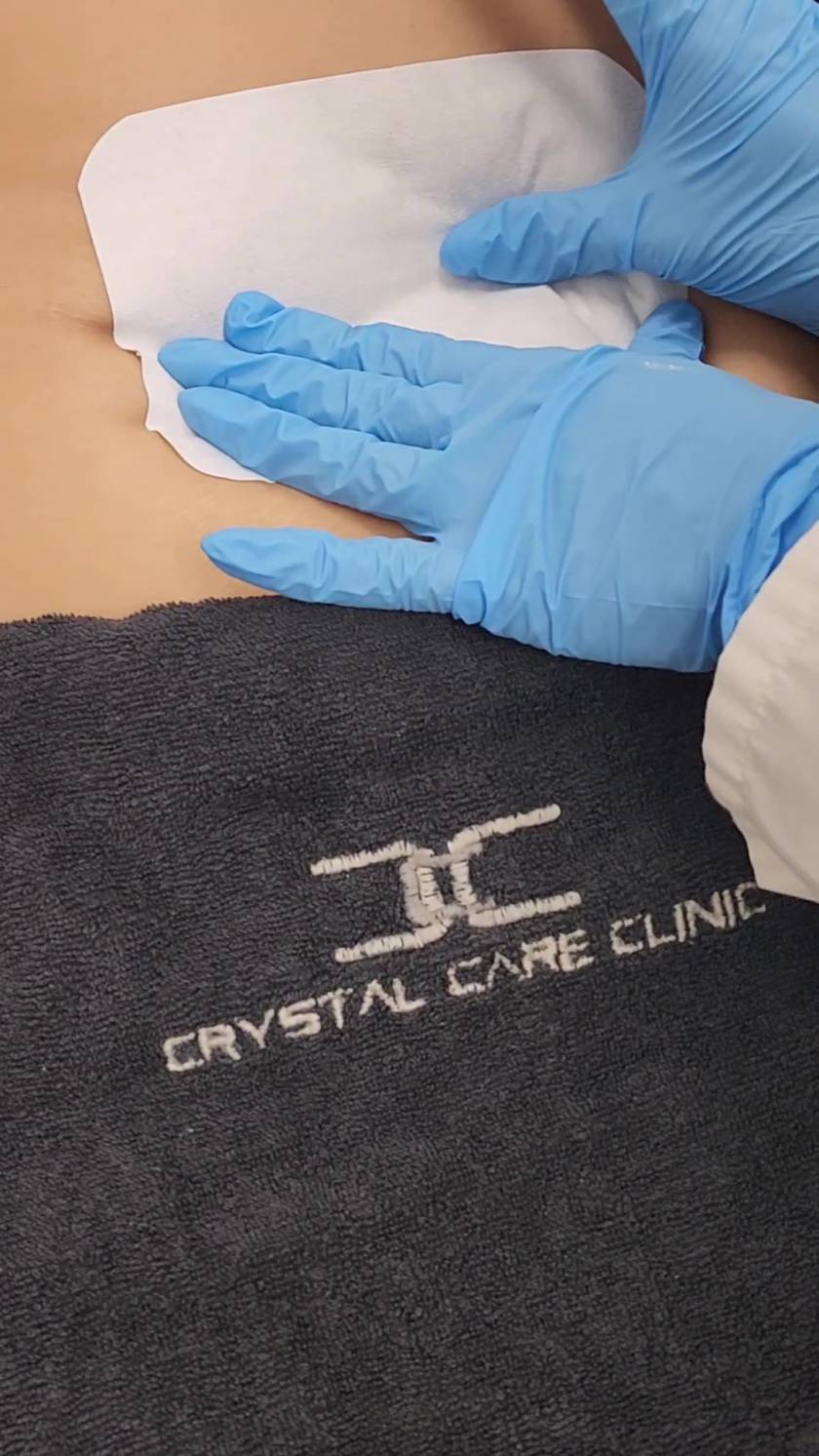 Profhilo skin booster - Crystal Care Clinic